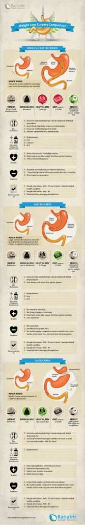 Pros and Cons of Lap Band Surgery - HRF