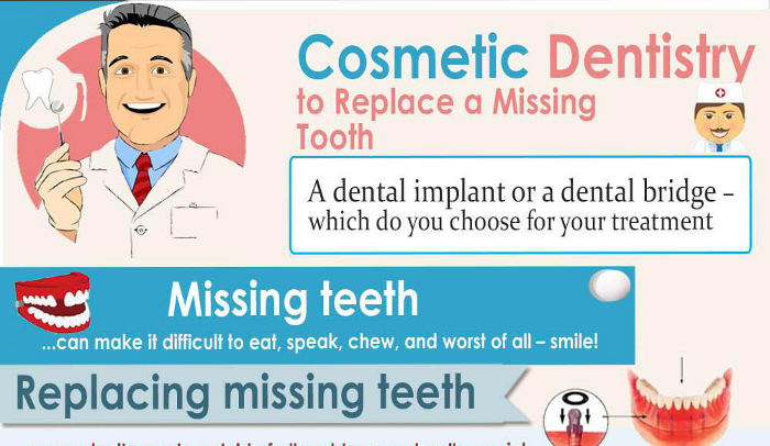 Dental Bridges Pros and Cons - HRF