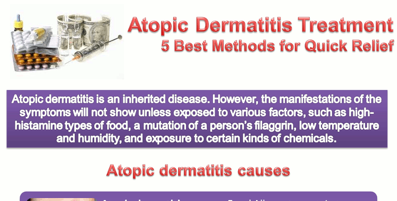 Nickel Allergy Symptoms - HRF