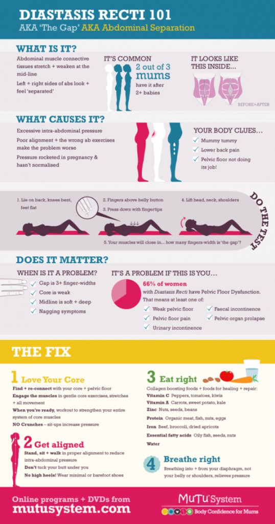 Diastasis Recti 101 AKA The Gap AKA Abdominal Separation - HRF